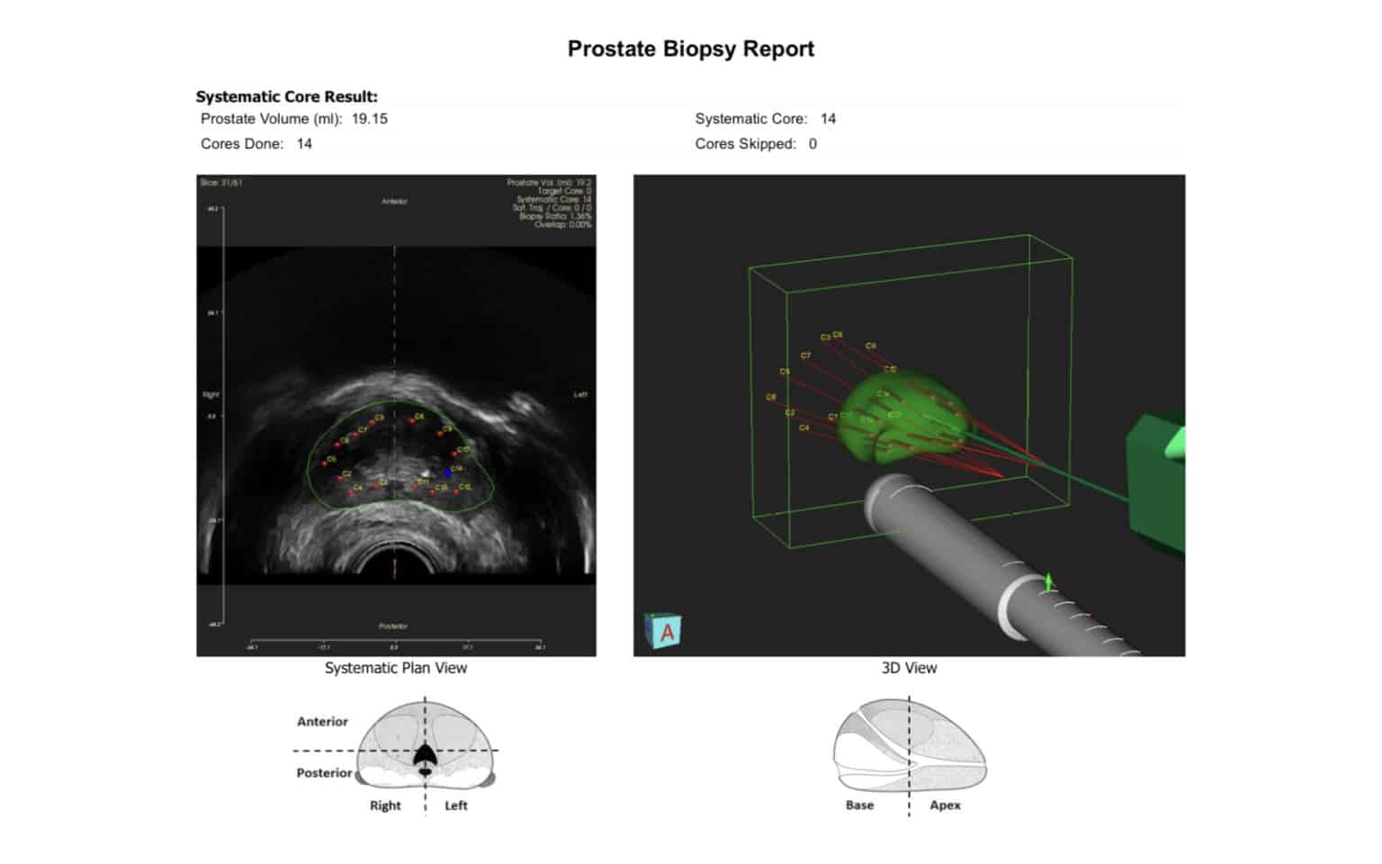 Biobot-Biopsie - Privatpraxis für Urologie